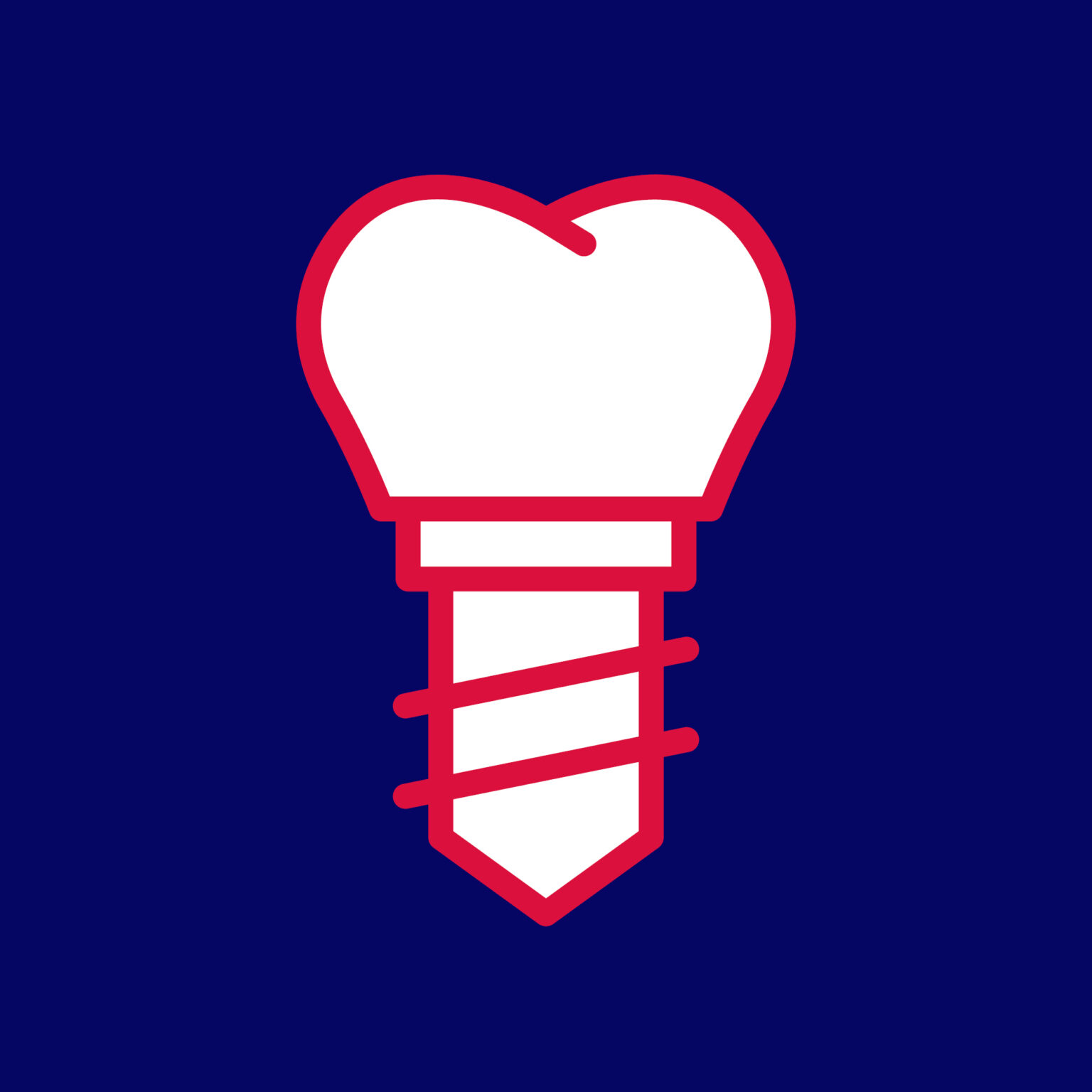 Digital library | MSDI implants