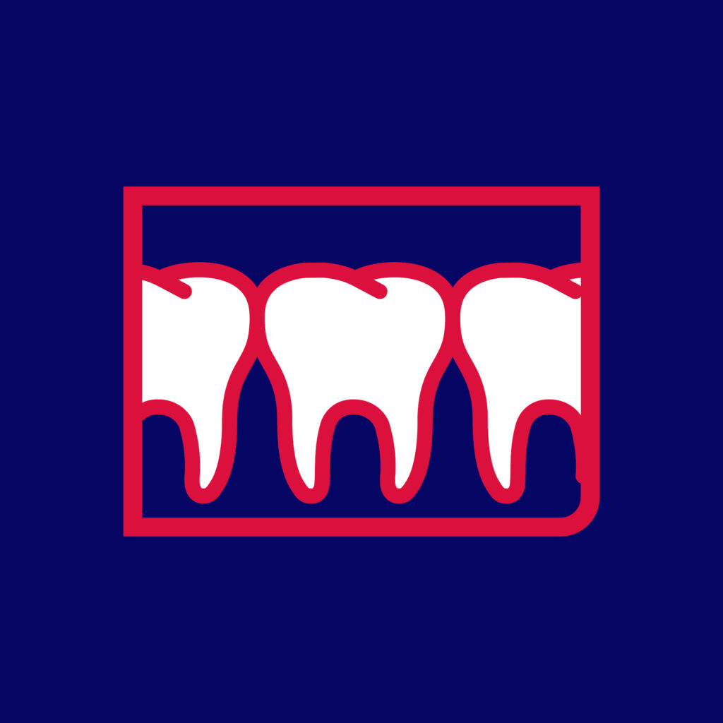 Digital library | MSDI implants